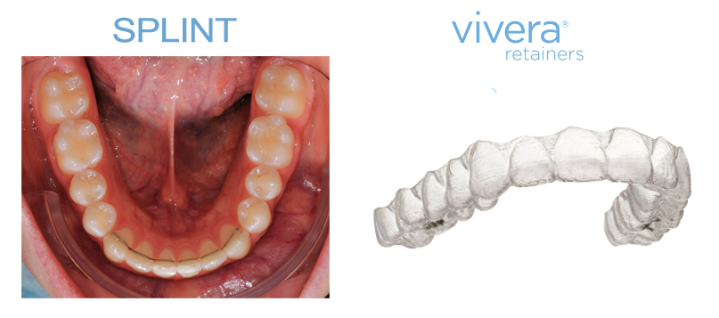 Altro sull'Ortodonzia - Dott.ssa Camilla Molinari